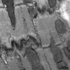 TEM Images | Bioscience Electron Microscopy Laboratory