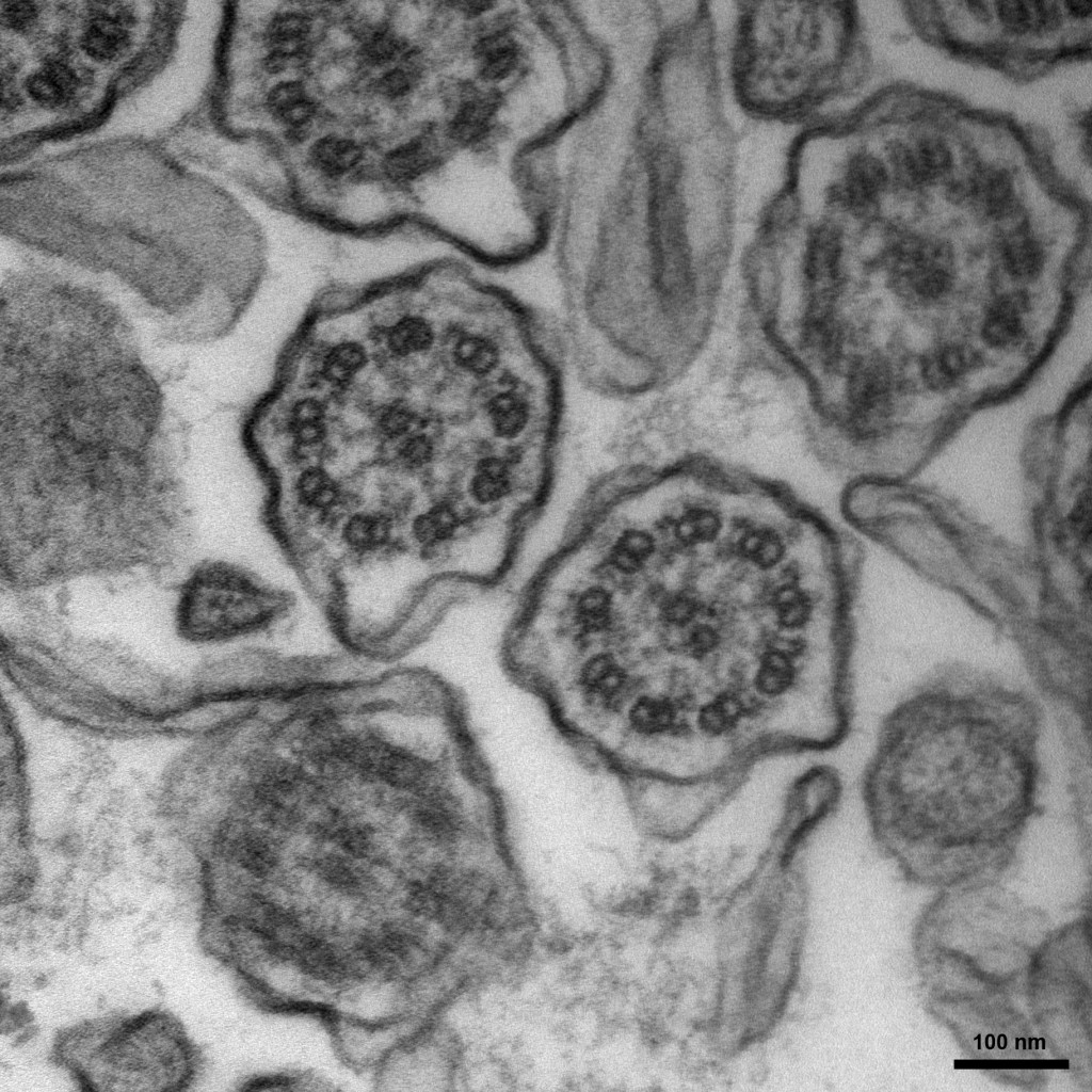 TEM Images | Bioscience Electron Microscopy Laboratory